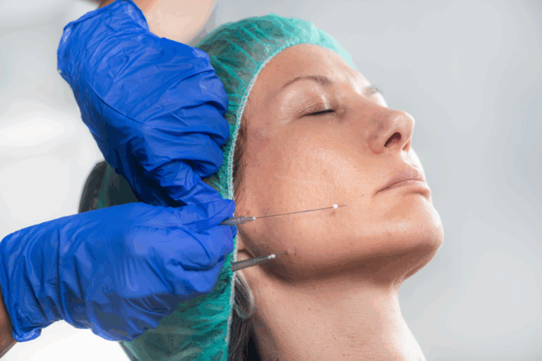Thread Lift and Collagen Boosting Facials in Orange City: What Patients ...